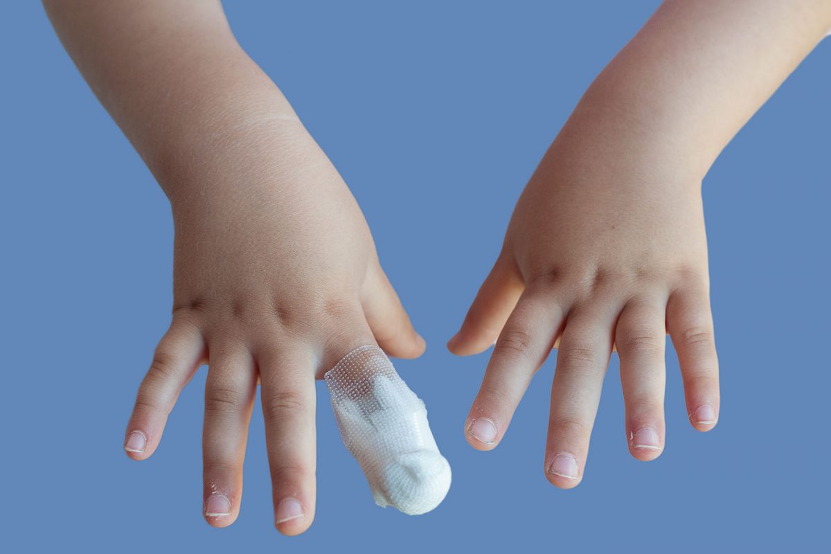 DFW Hand Surgeon Dr. Van Wyk | Dallas Hand Surgeons