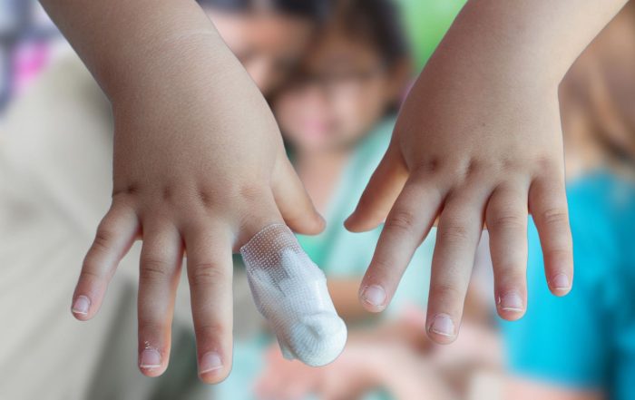 Pediatric & Congenital Hand & Upper Extremity Procedures & Conditions ...