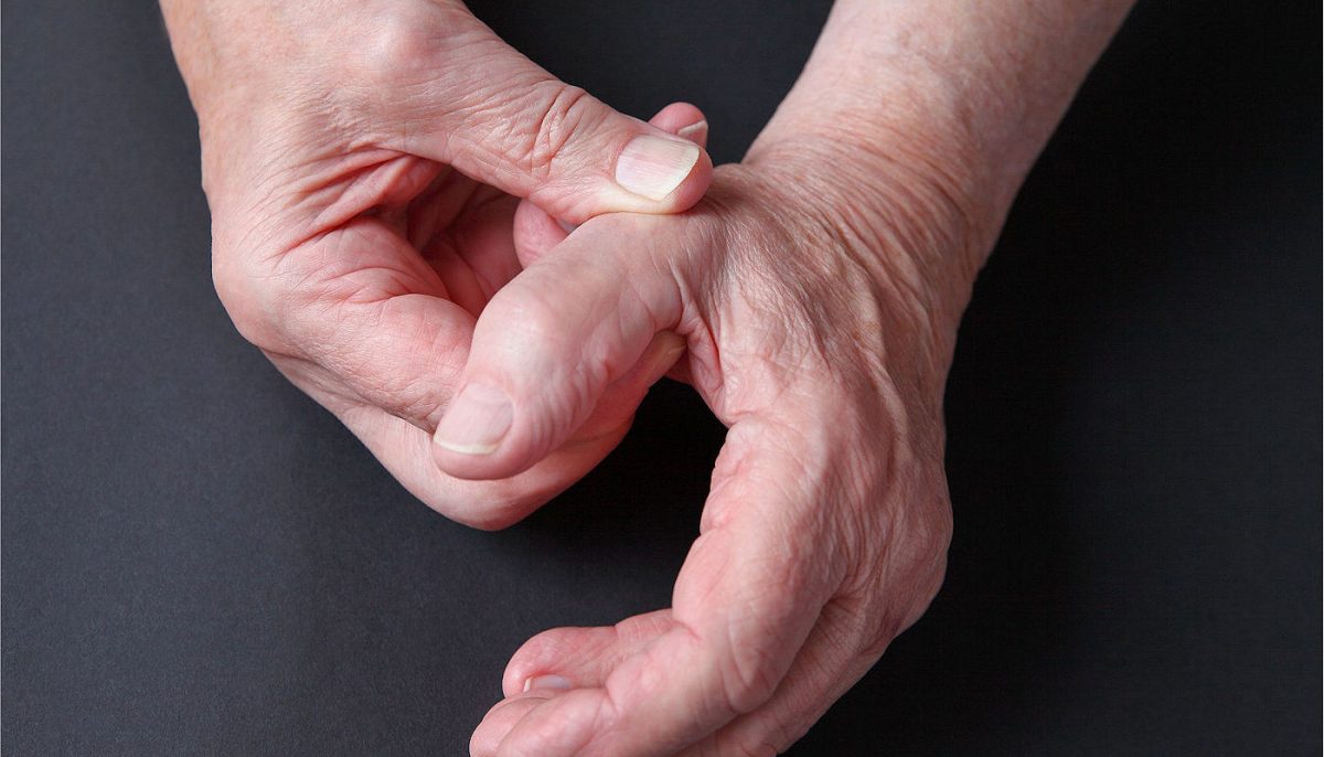 Metacarpophalangeal Joint Arthritis | DFW Hand Surgeon